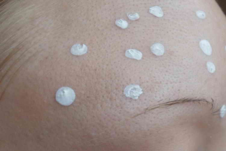 Ціндол від прищів: інструкція, застосування, відгуки - Корисні поради ...